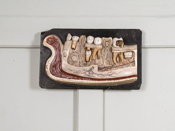 A 19th Century Plaster Didactic Model of Malformed Teeth – Drew ...